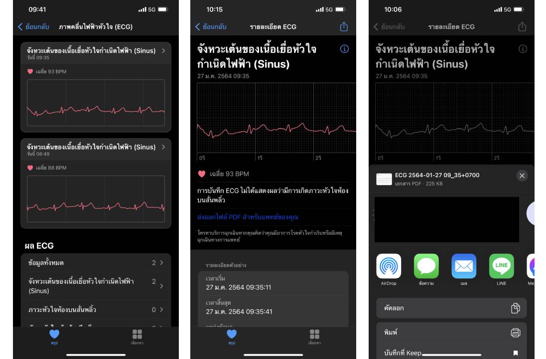 ECG วัดได้แล้ว บน watchOS 7.3 – Dailygizmo