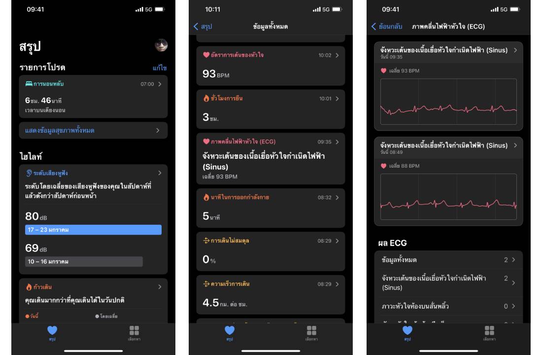 ECG วัดได้แล้ว บน watchOS 7.3 – Dailygizmo