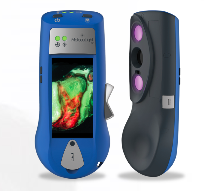 MolecuLight ตัวช่วยเช็คแผลติดเชื้อ รักษาหายเร็วขึ้น – Dailygizmo