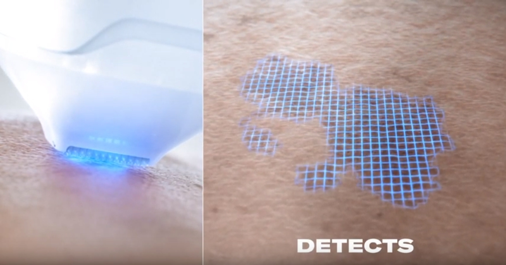 OPTE Skin ปริ้นเตอร์ที่ทำให้ -กระ- หาย.. – Dailygizmo